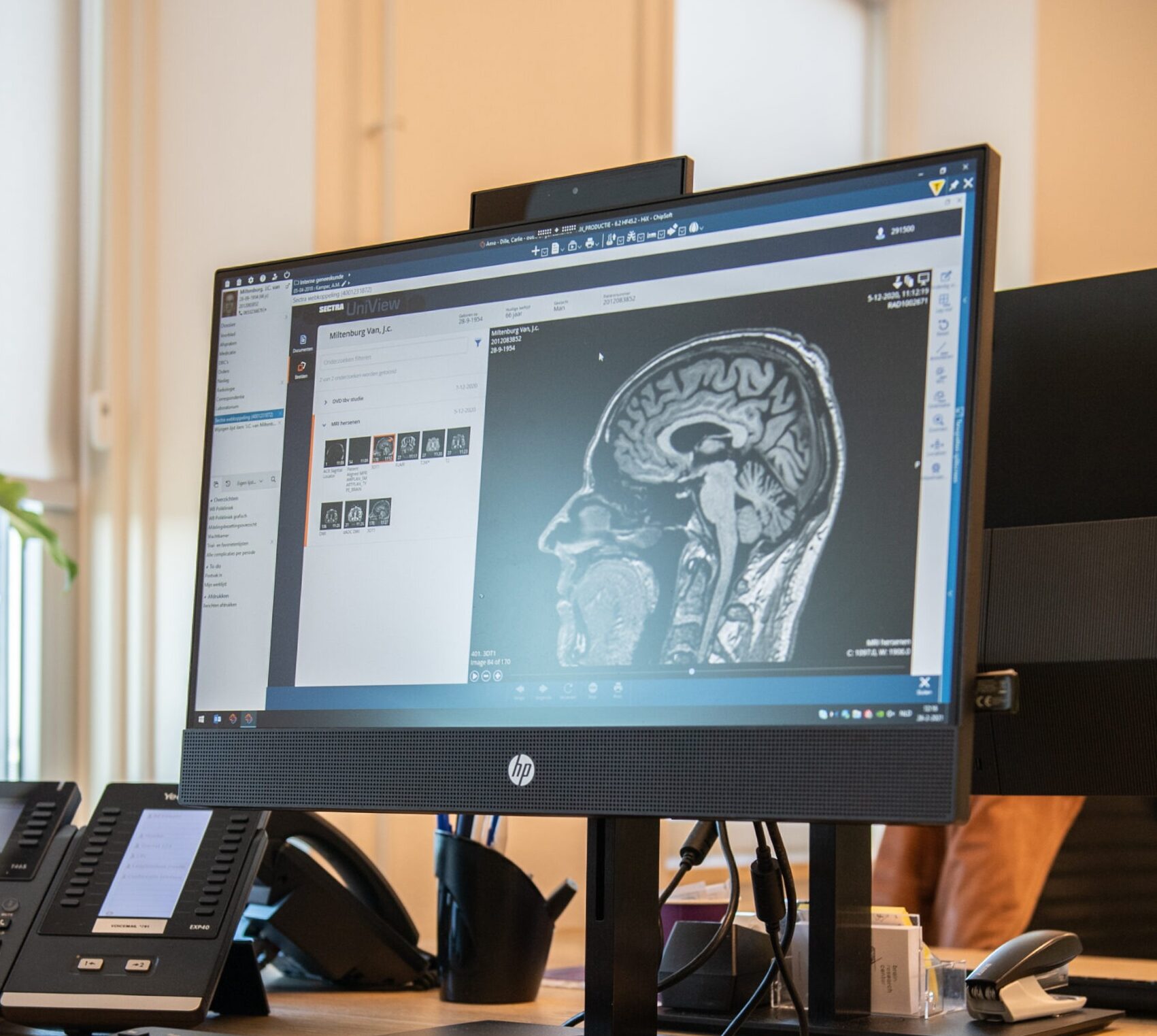 Dr. Niels Prins in de Telegraaf over Donanemab - Brain Research Center