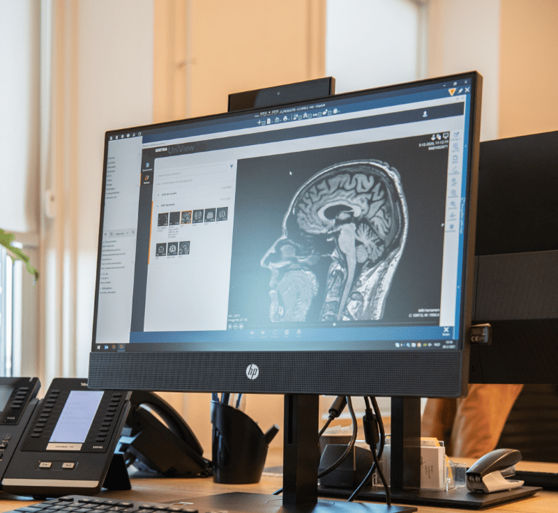 Wordt het simpeler om de ziekte van Parkinson te diagnosticeren?